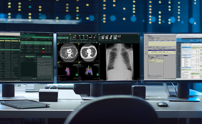 From Enhanced Diagnostics to Streamlined Workflow: How PACS System ... From Enhanced Diagnostics to Streamlined Workflow: How PACS System ...